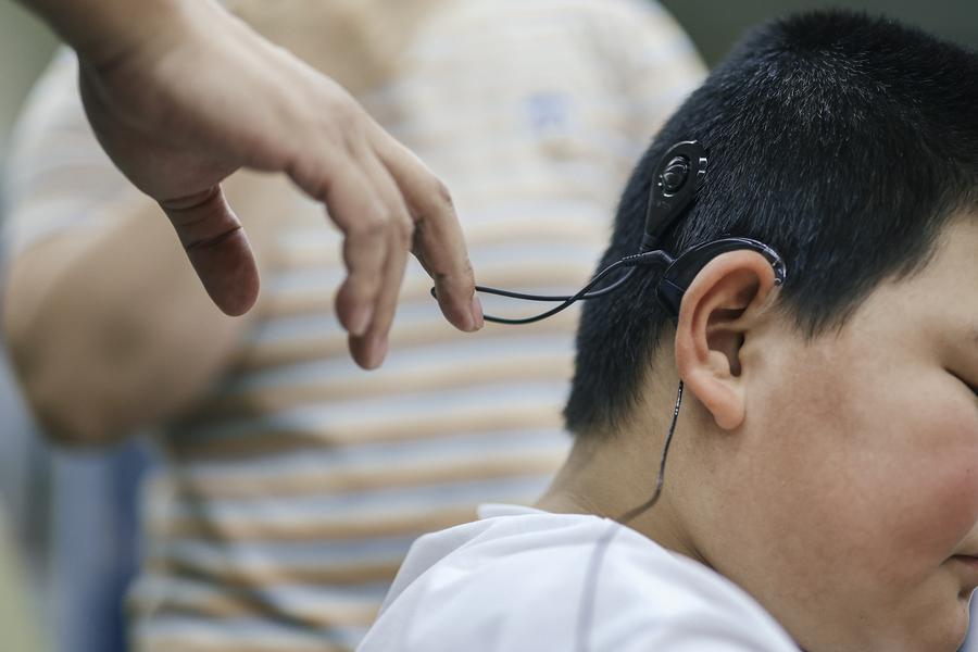 Nearly 90 pct of hearing-impaired children in China use cochlear ...
